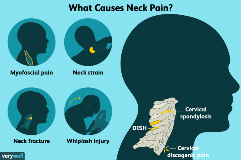 Neck Pain » RestoraLife | Causes and Treatment